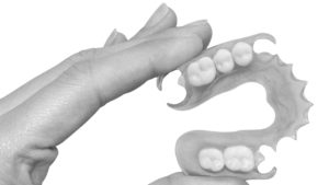 Prótese dentária móvel: os tratamentos e tipos de pontes removíveis.