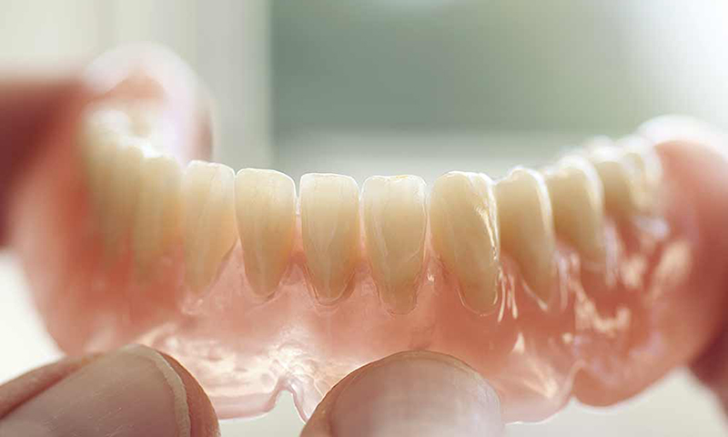 durabilidade dentadura e ponte móvel quanto tempo duram trocar - Luís ...