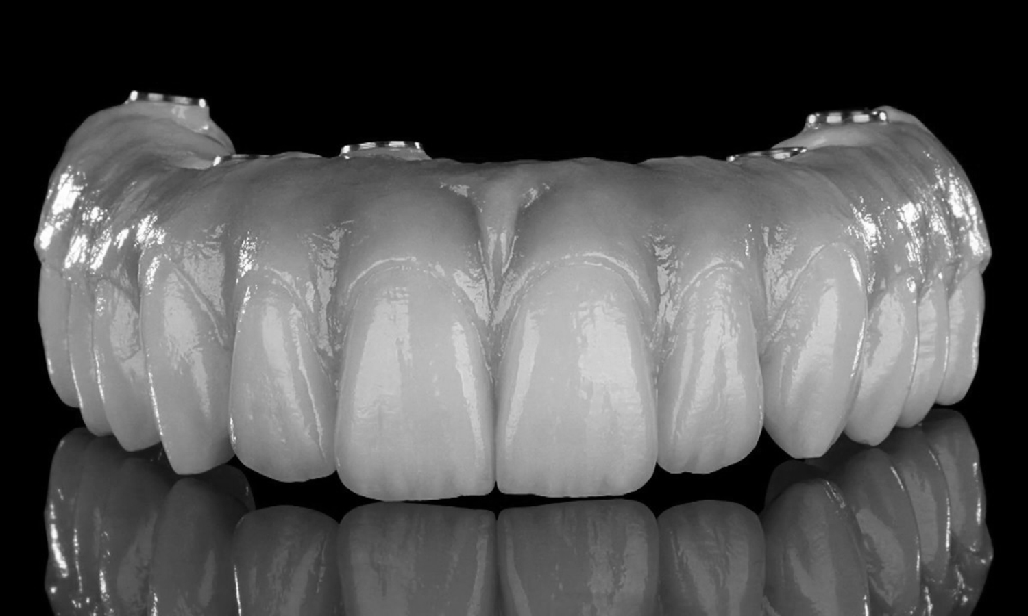 Prótese protocolo: veja quantos implantes dentários são necessários.